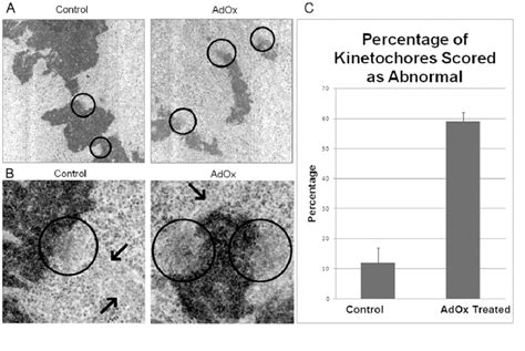 Transmission Electron Microscopy Tem Of Mitotic Hela Cells Reveals