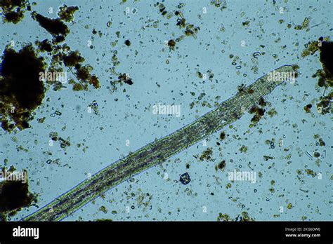 Human Parasite Gut Intestinal Infection Disease Microorganism