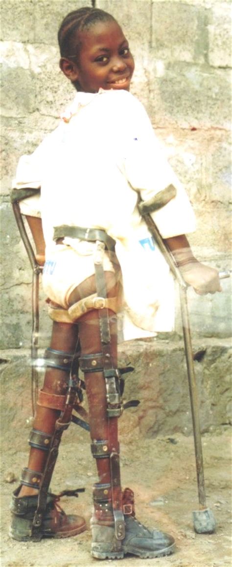 Polio Stand Proud