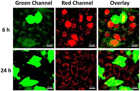 Dnazyme Mediated Genetically Encoded Sensors For Ratiometric Imaging Of