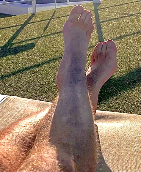Eric Petersens Feet