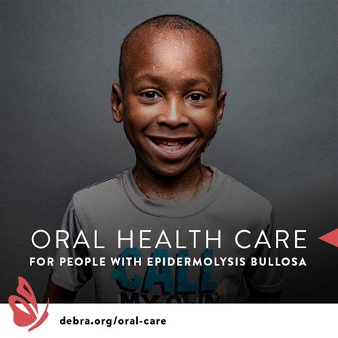Debra Of America On Linkedin In Many Forms Of Epidermolysis Bullosa