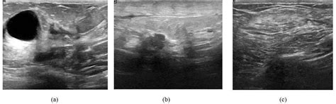 Classified Ultrasound Image Dataset With 3 Classes
