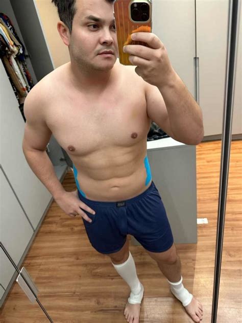 Matheus da dupla Kauan surpreende ao mostrar resultado de lipo Veja Metrópoles