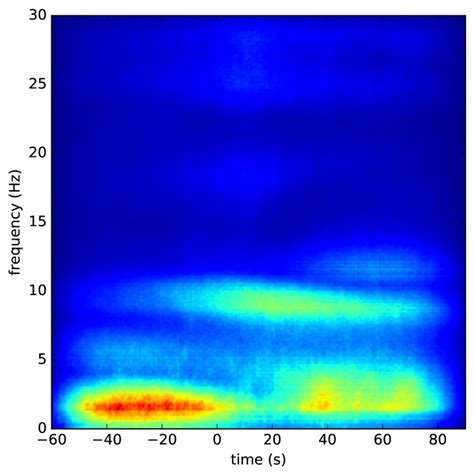 deep convolutional neural networks for interpretable analysis of eeg