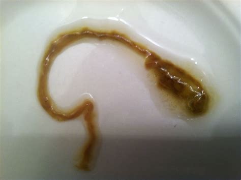 What Are Symptoms Of Tapeworms In Humans Printable Templates Protal