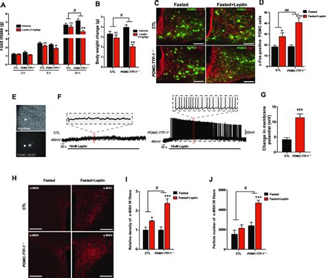 Pomc Neuron Specific Deletion Of Ttf 1 Leads To Increased Sensitivity