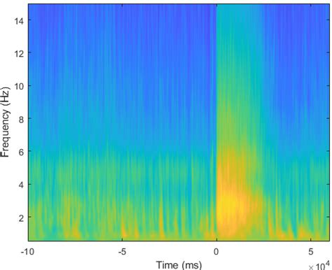 Example Of Time Frequency Plot The X Axis Represents The Time Points Download Scientific