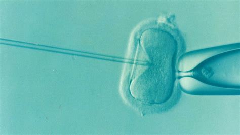 認識試管嬰兒 Ivf 奶奶的熊