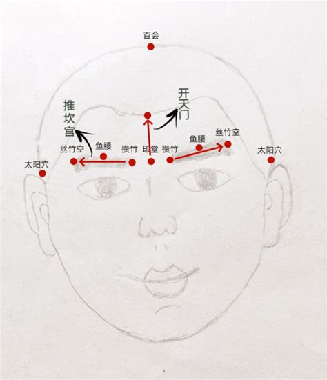 “要命”的头痛，护士你还在硬抗吗？ 睡眠 工作 因素
