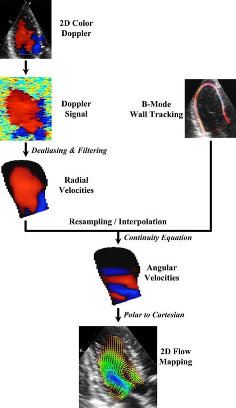 Flowchart Of The Method Of Doppler And B Mode Acquisitions And Digital