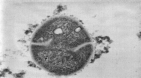 Streptococcus Uberis M2 Magazine