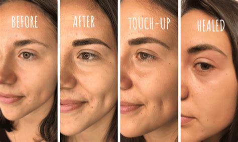 Microblading Healing Process What To Expect The Daily Glimmer