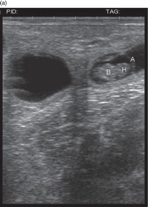 Reproductive Ultrasound Of Female Cattle Veterian Key