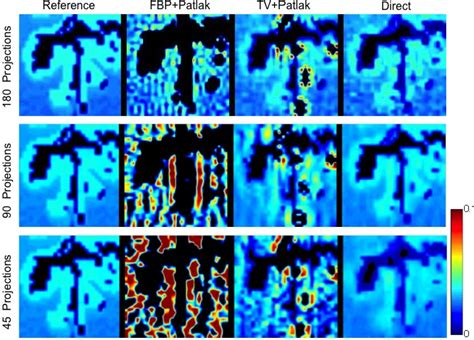 Figure 5 From Direct Estimation Of Permeability Maps For Low Dose Ct Perfusion Semantic Scholar