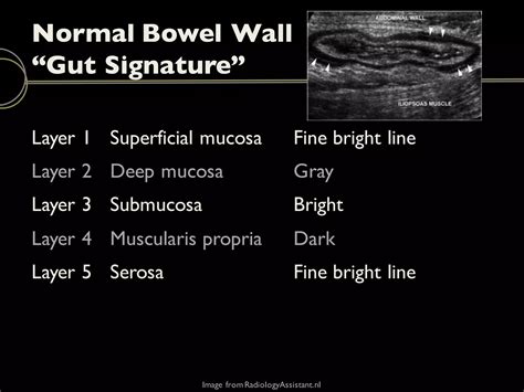 Emergency Ultrasound Bowel Pdf