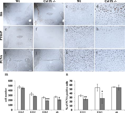 Analysis Of The Ihhpthrp Feedback Loop In The Embryonic Lumbar Spine