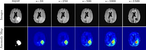 figure 5 from diffusion models for medical anomaly detection semantic