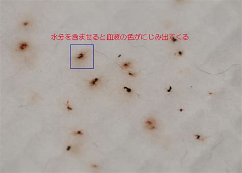 寄生虫の病気きゅうたん犬猫病院静岡市葵区の動物病院