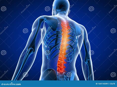 3d Rendered Medically Accurate Illustration Of A Man Having A Painful