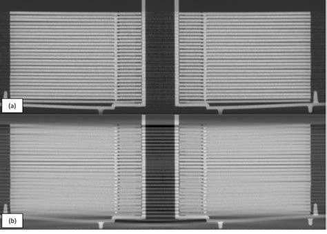 Advantages Of Helical Spiral CT Scanning North Star Imaging