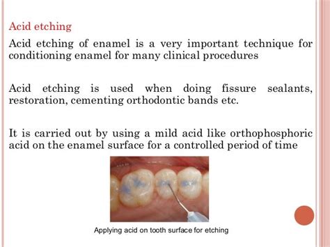 Enamel