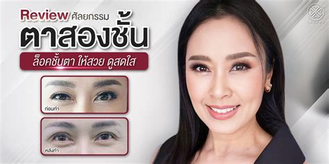 รีวิวศัลยกรรม Luxury Clinic Thailand