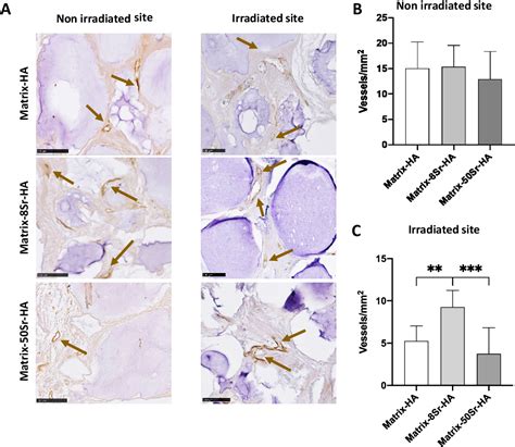 Figure 1 From Bone Regeneration In Small And Large Segmental Bone