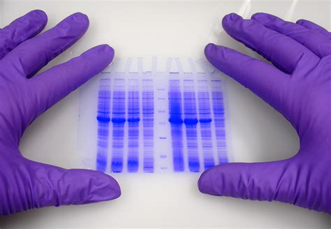 Production Of Recombinant Proteins In A Soluble Form In Li Arvys