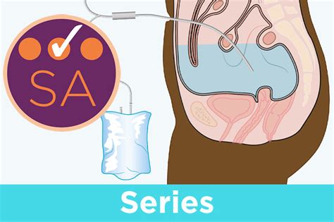 Renal System 4 Causes Diagnosis And Treatment Of Chronic Kidney