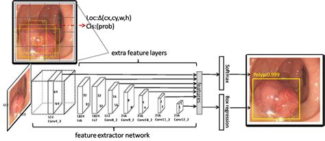 Proposed SSD Polyp Detection Framework Architecture Feature Download Scientific Diagram