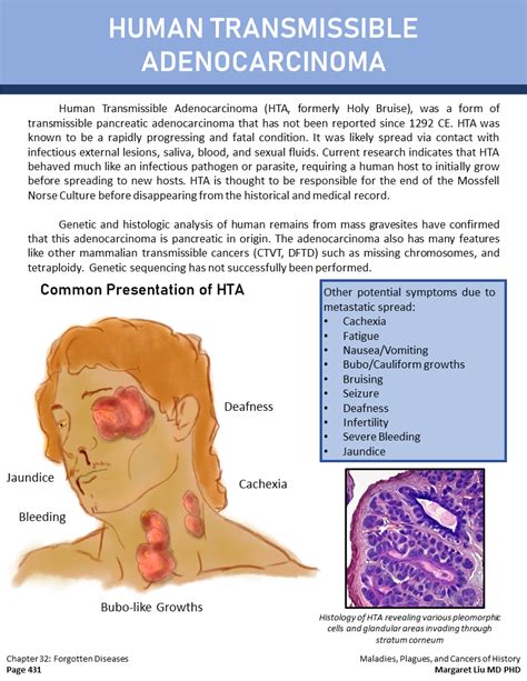 Human Transmissible Adenocarcinoma Transmissible Cancer And The End