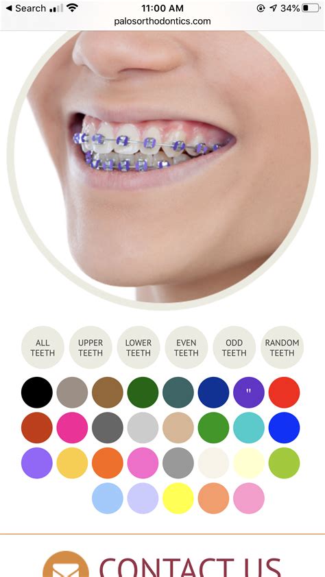 What Is The Best Color For Braces