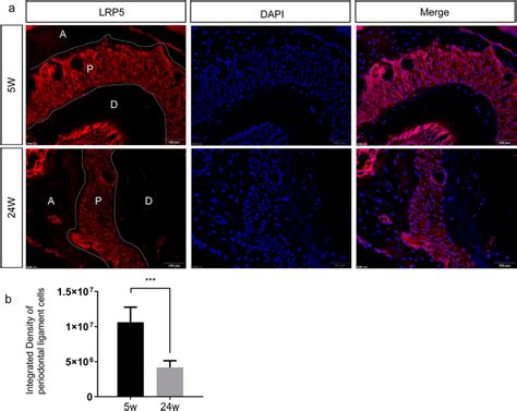 Decreased Expression Of Lrp5 In Periodontal Ligament Cells Of Aged