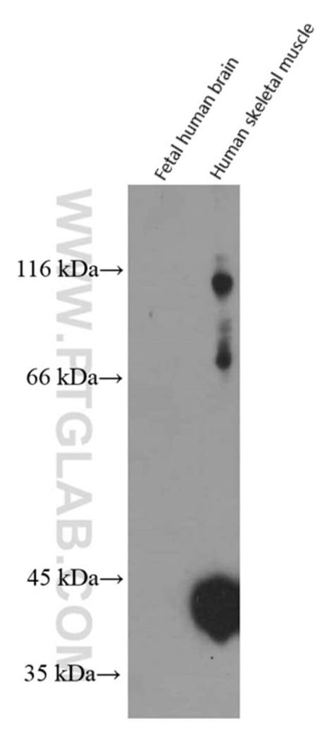 Ckm Mouse Anti Human Mouse Rat Clone 2g3f6 Proteintech 20 μl