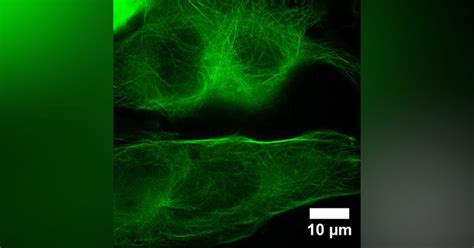 New Biosensor Provides Spatially Resolved Hydrogen Peroxide Sensing In Cells Laser Focus World