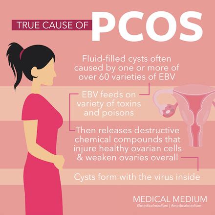 True Cause Of Pcos