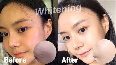 Eng ☀️햇빛에 탄 피부 하얘지는 방법 기미 까만얼굴 검버섯 그을림 붉어짐 민감성 이젠 집에서 관리 해봐용🌱 Youtube