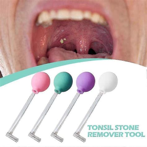 Tonsil Stone Removertonsil Stone Removal Tool Kittonsil Stone Water