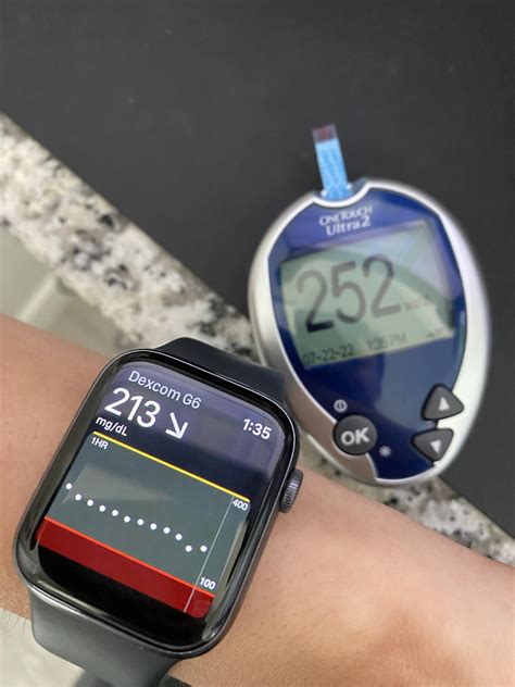 Why Dexcom Meter Why 🫠 R Diabetes