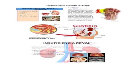 Enfermedades Aparato Excretor · Del Sistema Excretor Aunque Suele