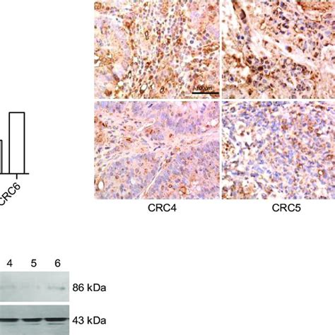 analysis of smurf1 expression in crc tissues a smurf1 rna levels were