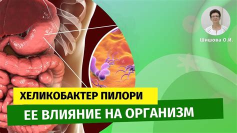 Хеликобактер пилори её влияние на организм [Шишова О И ] Youtube
