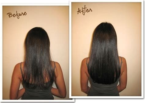 Before And After Nioxin Nioxin Shampoo Review Hold The Hairline
