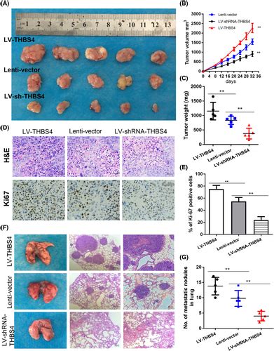 Thbs4 Promotes Hcc Progression By Regulating Itgb1 Via Fakpi3kakt