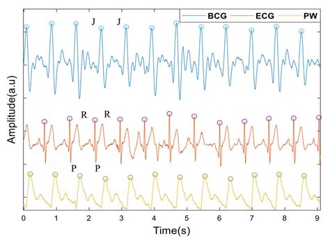 Peak Detection Of The Bcg Ecg Pw Signals Circles Indicate Time Download Scientific Diagram