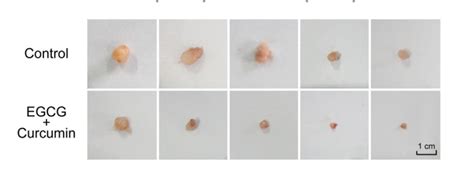 实证姜黄素结合EGCG有望强烈抑制非小细胞肺癌细胞的生长 凤凰网