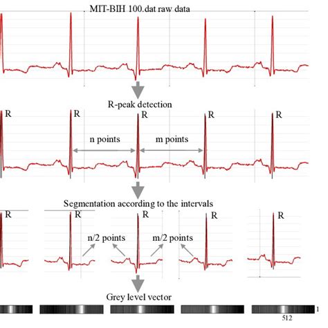 data preprocessing pipeline using heartbeats in the mitdb record 100