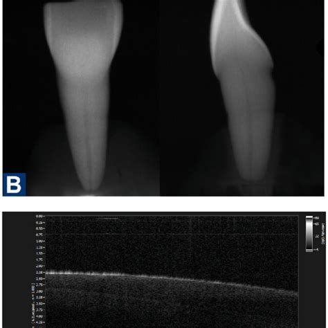Example Showing A Control Tooth Incisor A Clinical Photo B Download Scientific Diagram