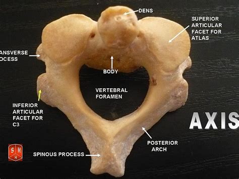 Axis Vertebrae Diagram Vertebral Column Anatomy